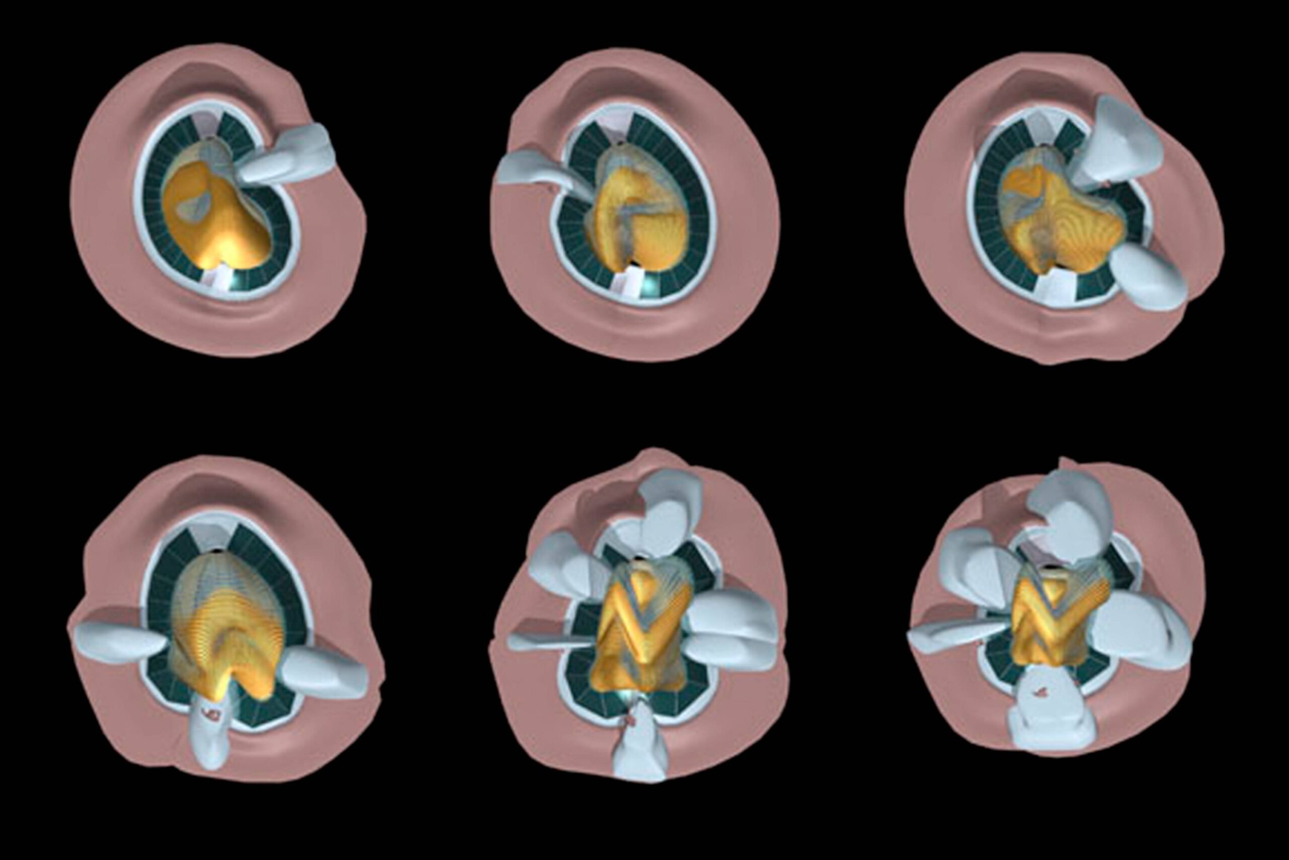 Greg Lynn, Embryologic House, 1998 · SFMOMA